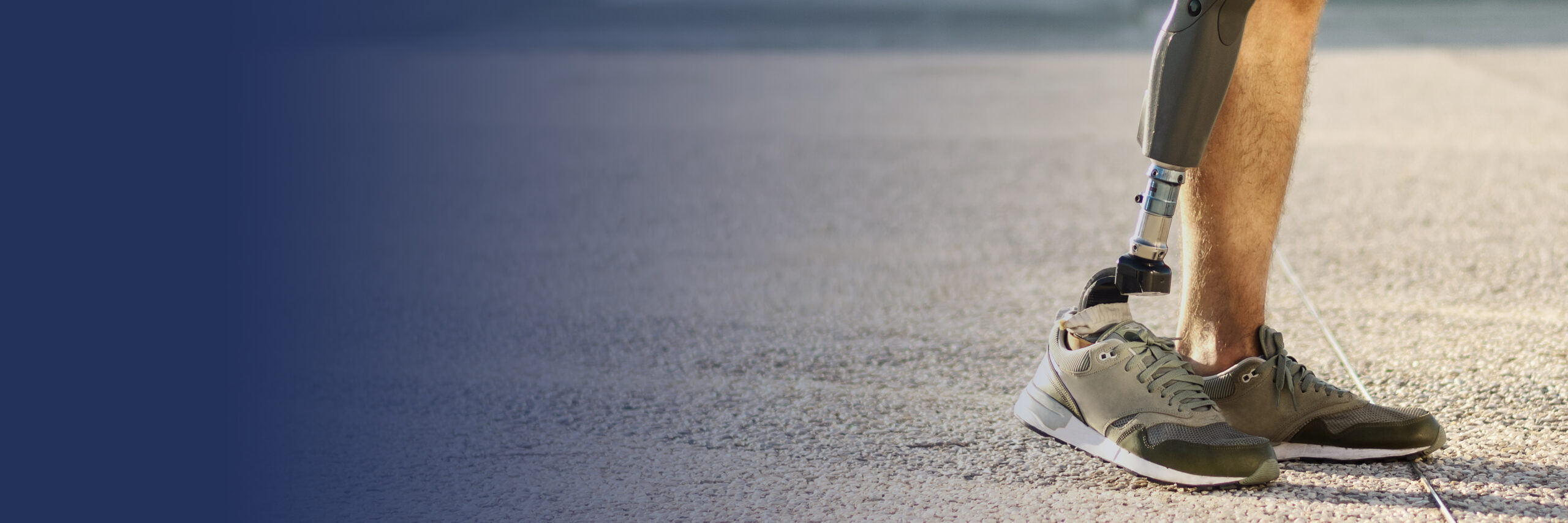 Workers’ Compensation for FL Amputation Injuries - Rosenberg & Rosenberg